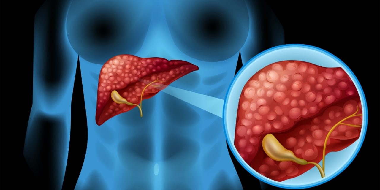 Liver Function Testing & FibroScan in Texas - Gastroenterology ...